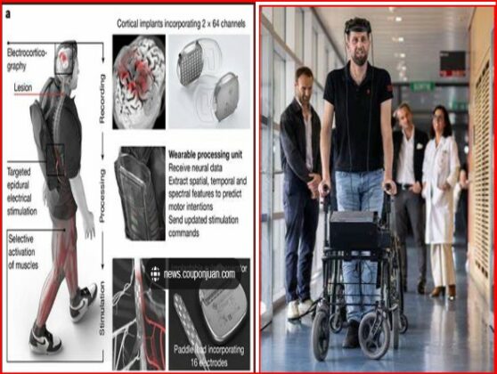Paralyzed man walking again with the help of a digital brain bridge ...